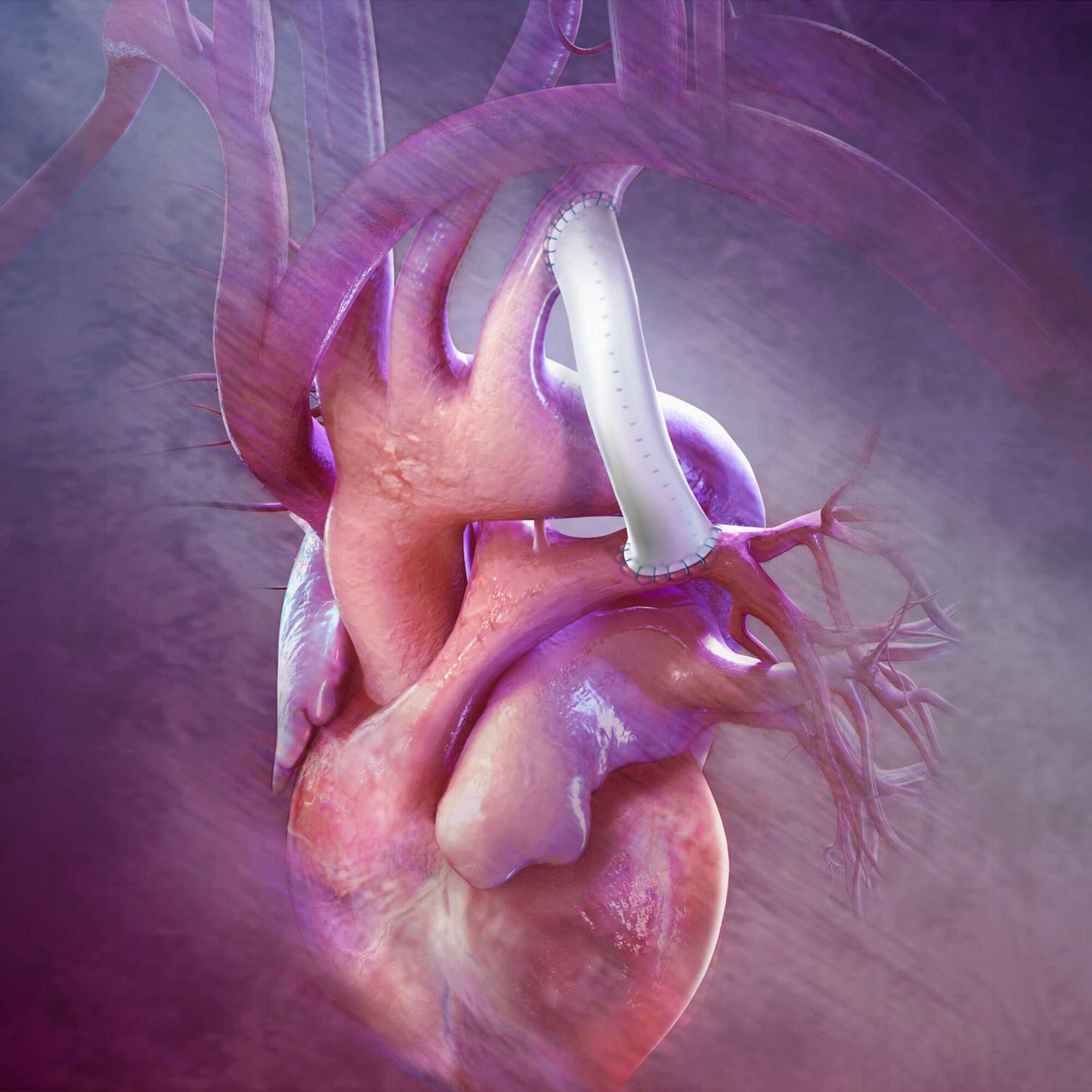 Cardiothoracic Surgery – Healthcare21