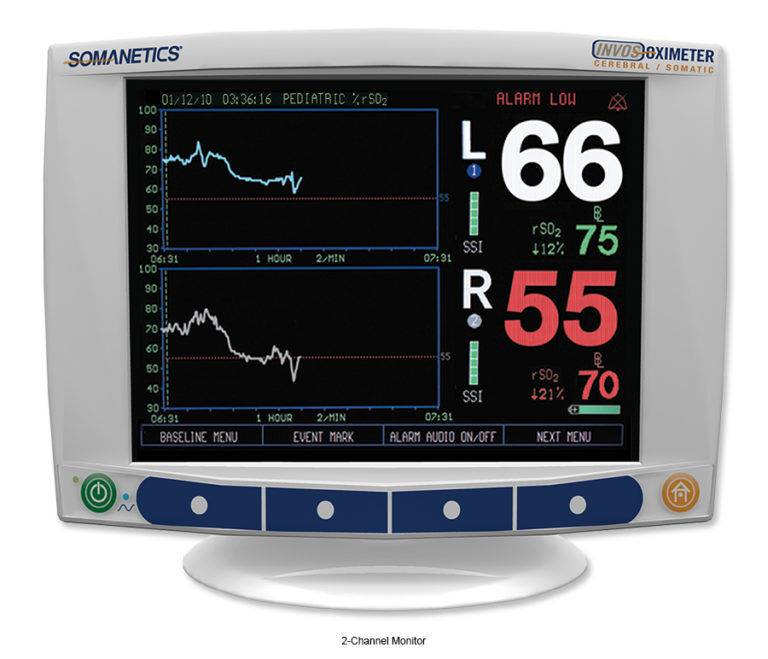 INVOS Cerebral Somatic Oximetry – Healthcare21