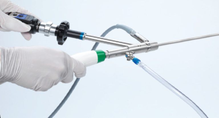 MyoSure Hysteroscope Tissue Remove System – Healthcare21