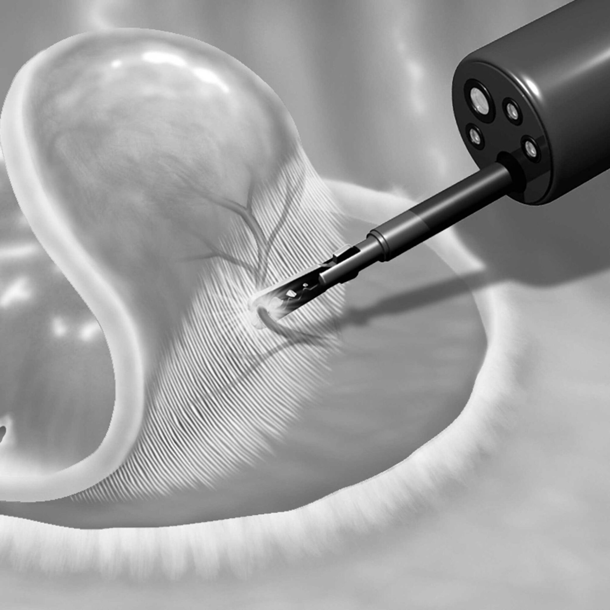 Disposable 3 Way Cystoscopy Tap - Healthcare21