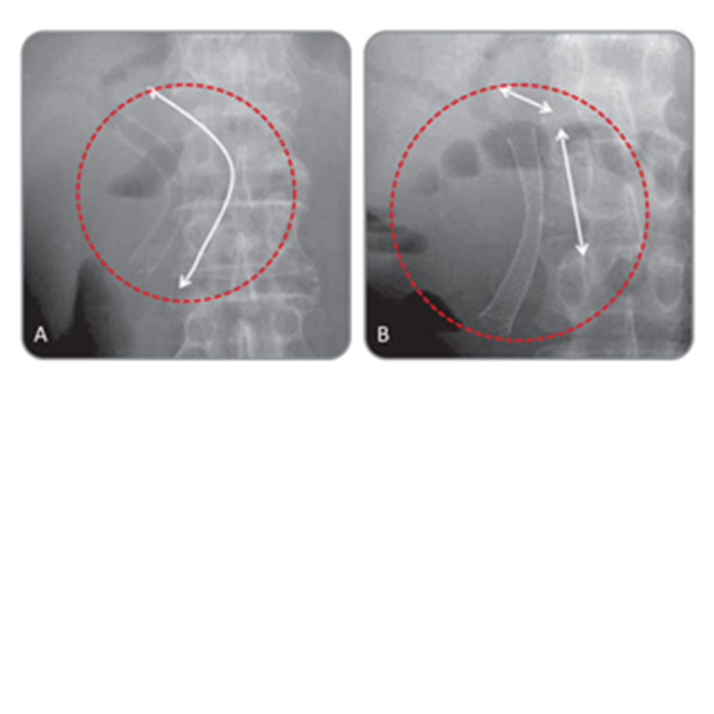 Endotherapy Devices & Accessories – Healthcare21