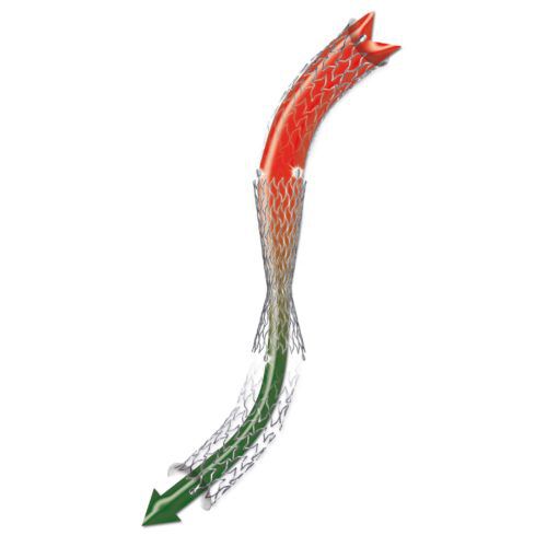 sinus-Reduction Stent – Healthcare21