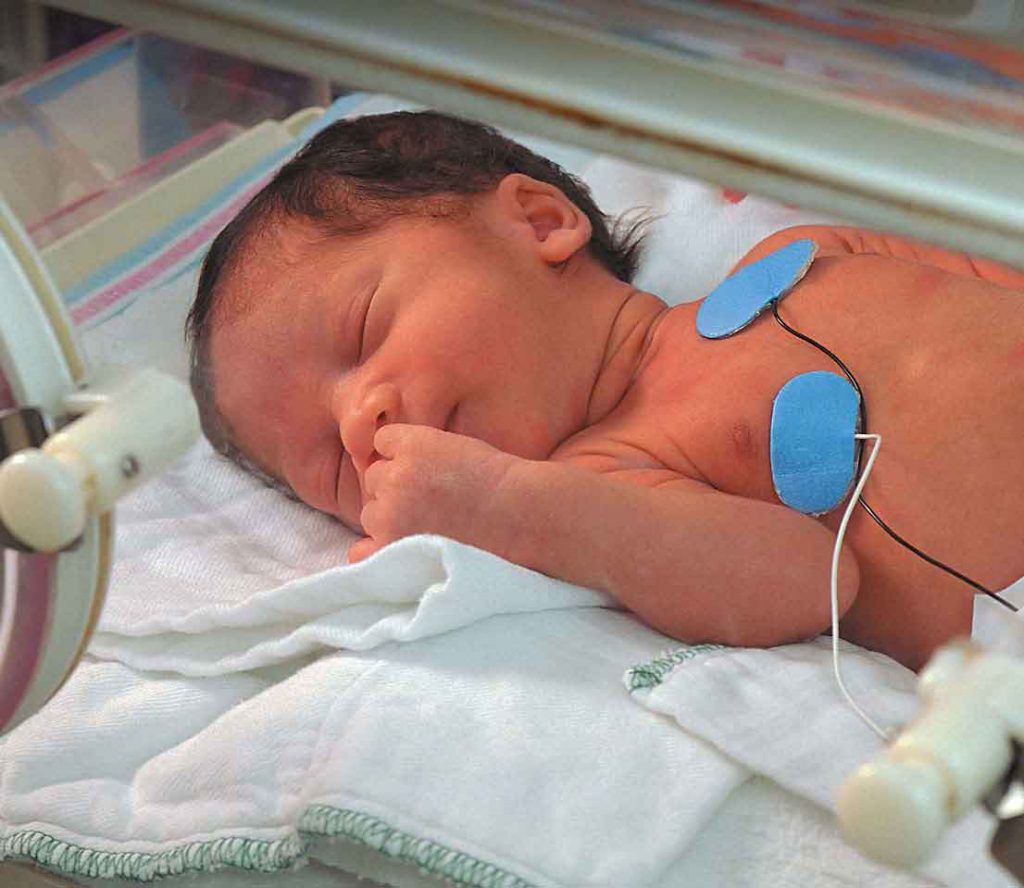 TransWarmer Infant Warming Mattress – Healthcare21