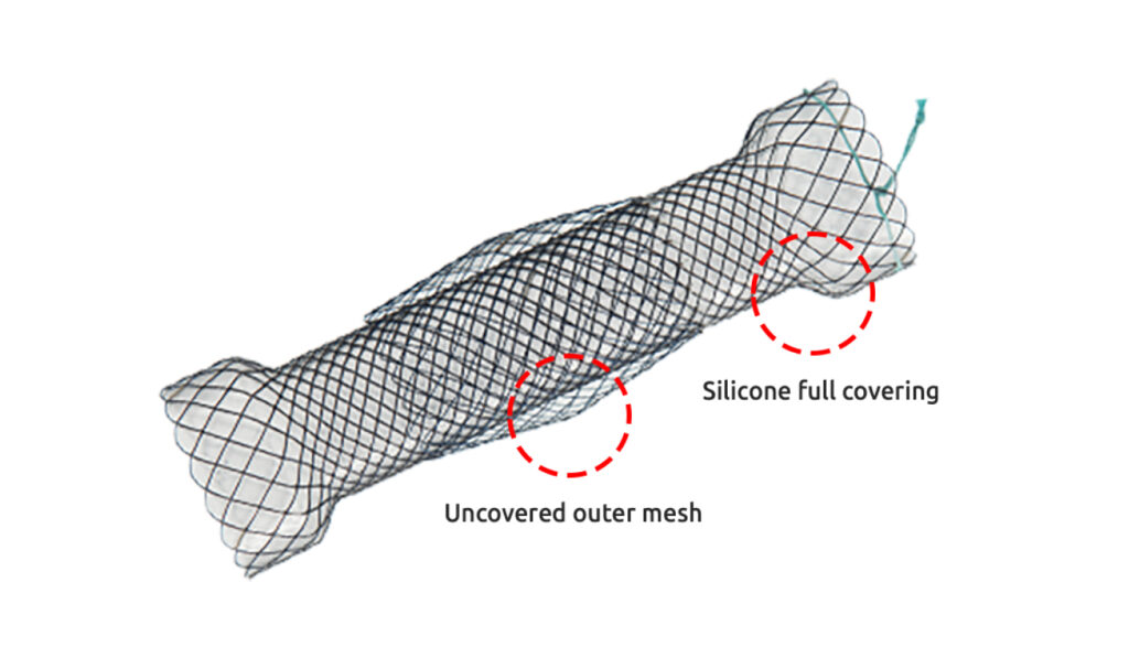 Novel oesophageal stent to reduce migration from TaeWoong – Healthcare21